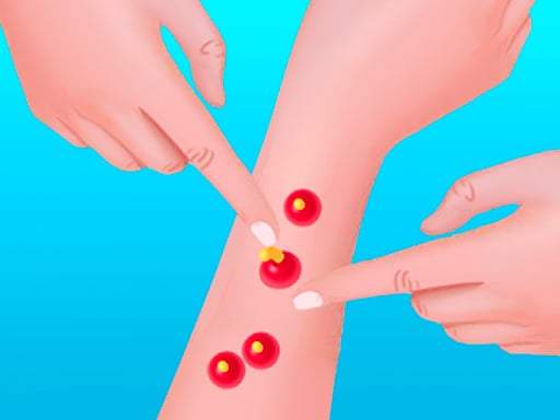 Pimple Poper Rush - Play free online - CrazyGames-Poki